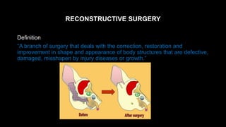 reconstructive surgery techniques | PPTX