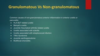 Approach to treating Uveitis.pdf