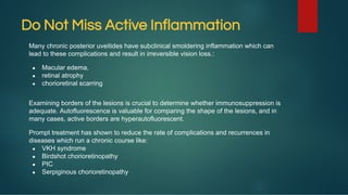 Approach to treating Uveitis.pdf