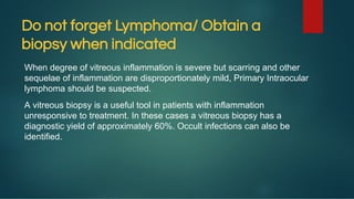 Approach to treating Uveitis.pdf
