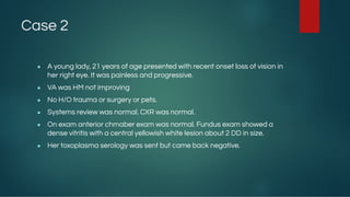 Approach to treating Uveitis.pdf
