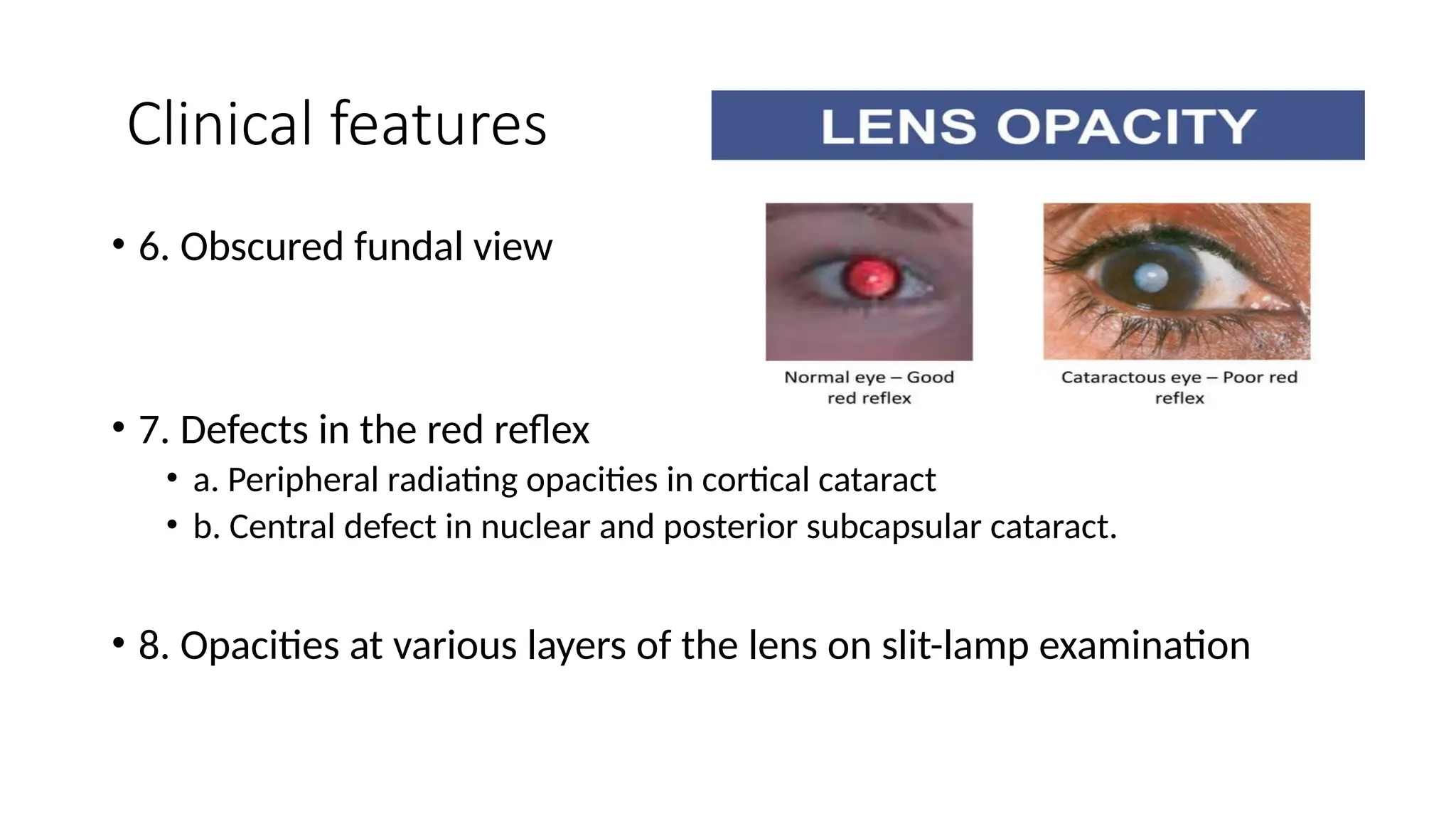 CATARACT made easy and in great detail.pptx