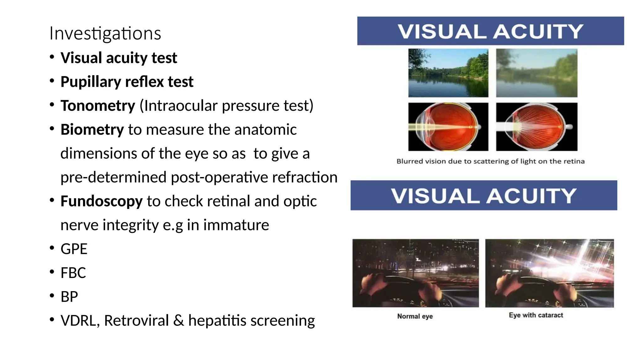 CATARACT made easy and in great detail.pptx