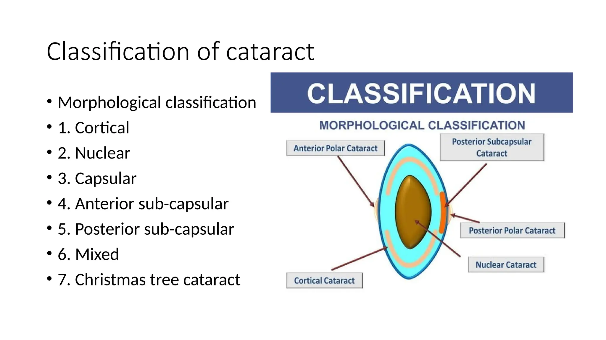 CATARACT made easy and in great detail.pptx