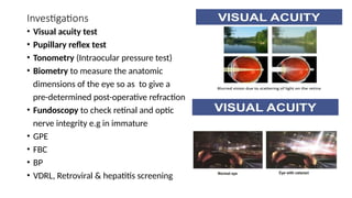 CATARACT made easy and in great detail.pptx