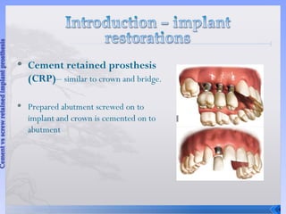 Cement vs screw retained implant prosthesis.ppt