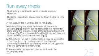 Complex cases in Cataract surgery and its management.pptx