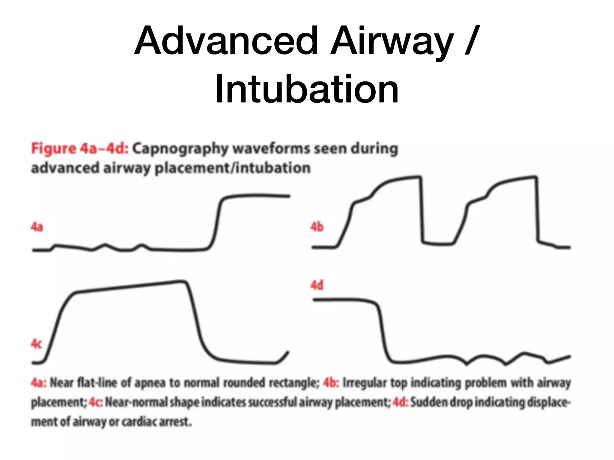 Capnography in emergency room | PDF