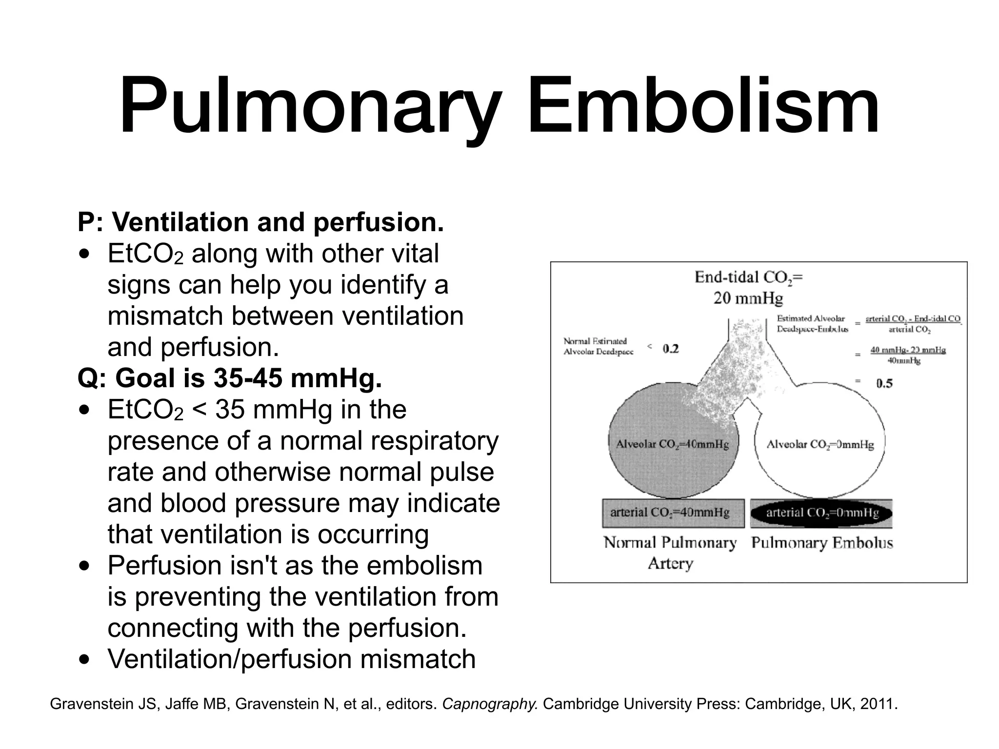 Capnography in emergency room | PDF