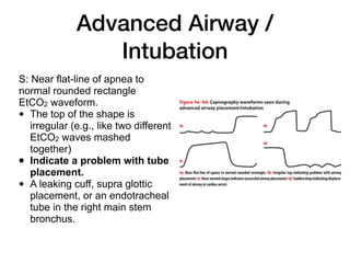 Capnography in emergency room | PPT