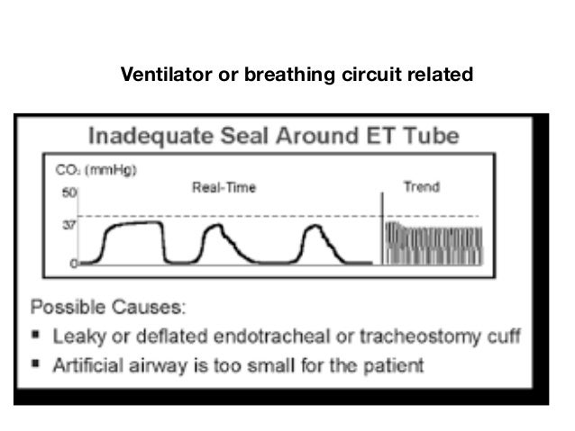 Capnography in emergency room