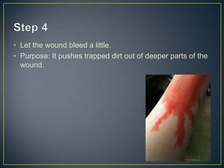 First Aid Presentation: Minor Burn and Moderate Road Rash | PPTX