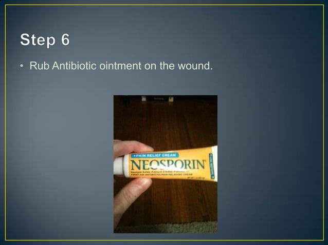 First Aid Presentation: Minor Burn and Moderate Road Rash | PPT