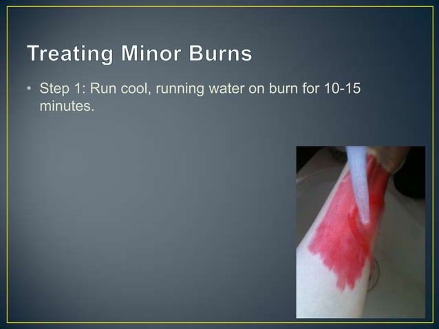 First Aid Presentation: Minor Burn and Moderate Road Rash | PPT