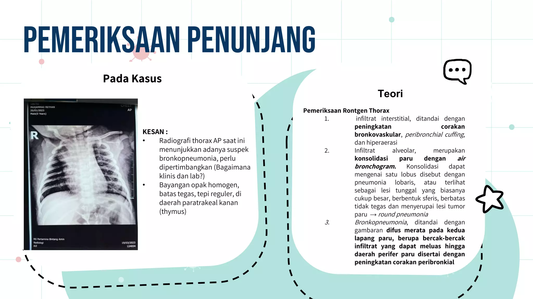 Laporan Kasus Bronkopneumonia Aulia Dwi Juanita.pptx