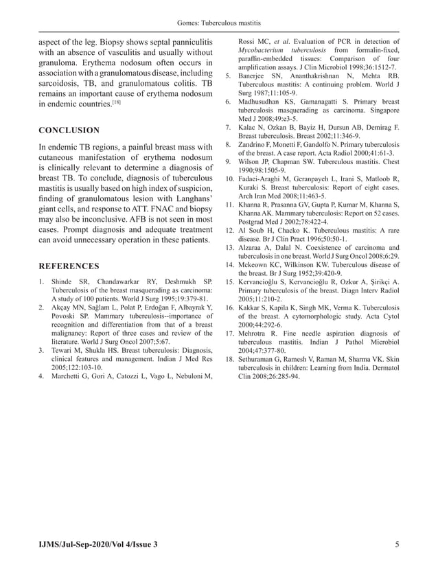 A rare case of tuberculous mastitis mimicking breast carcinoma | PDF
