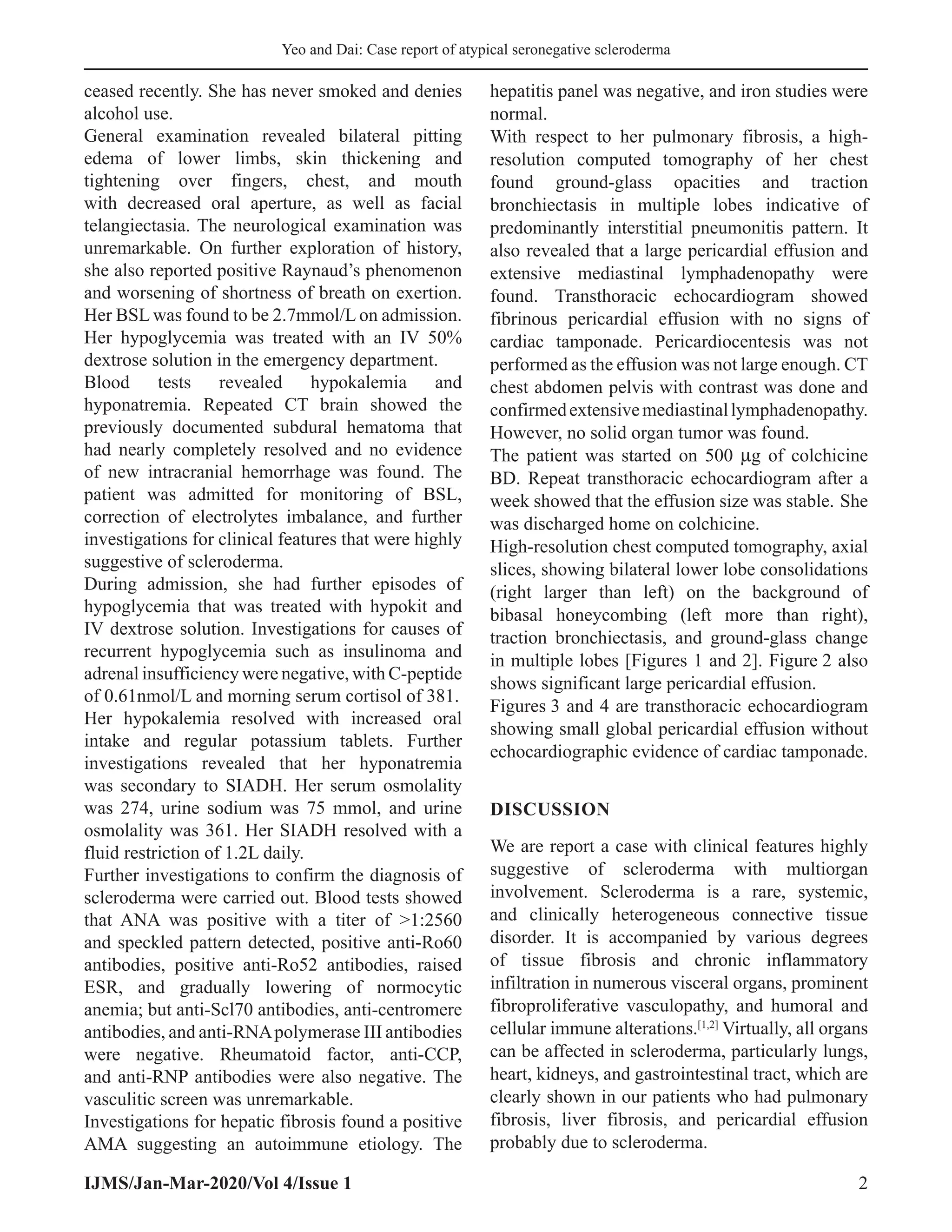 Case report of atypical seronegative scleroderma | PDF
