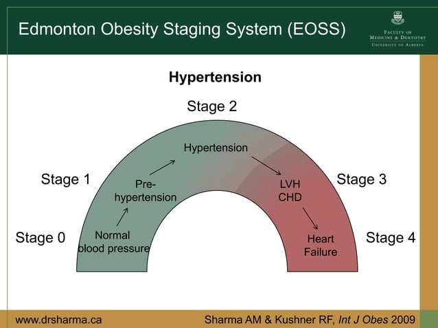 Edmonton obesity staging system | PPTX