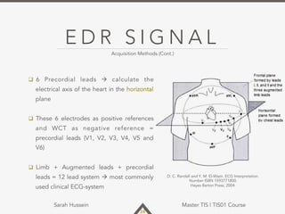 Electrocardiogramm Derived Respiratory Signal (EDR signal) | PDF