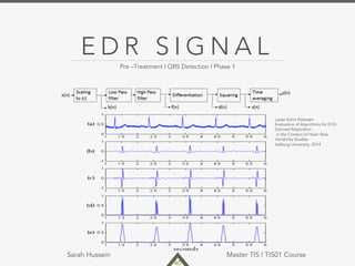 Electrocardiogramm Derived Respiratory Signal (EDR signal) | PDF