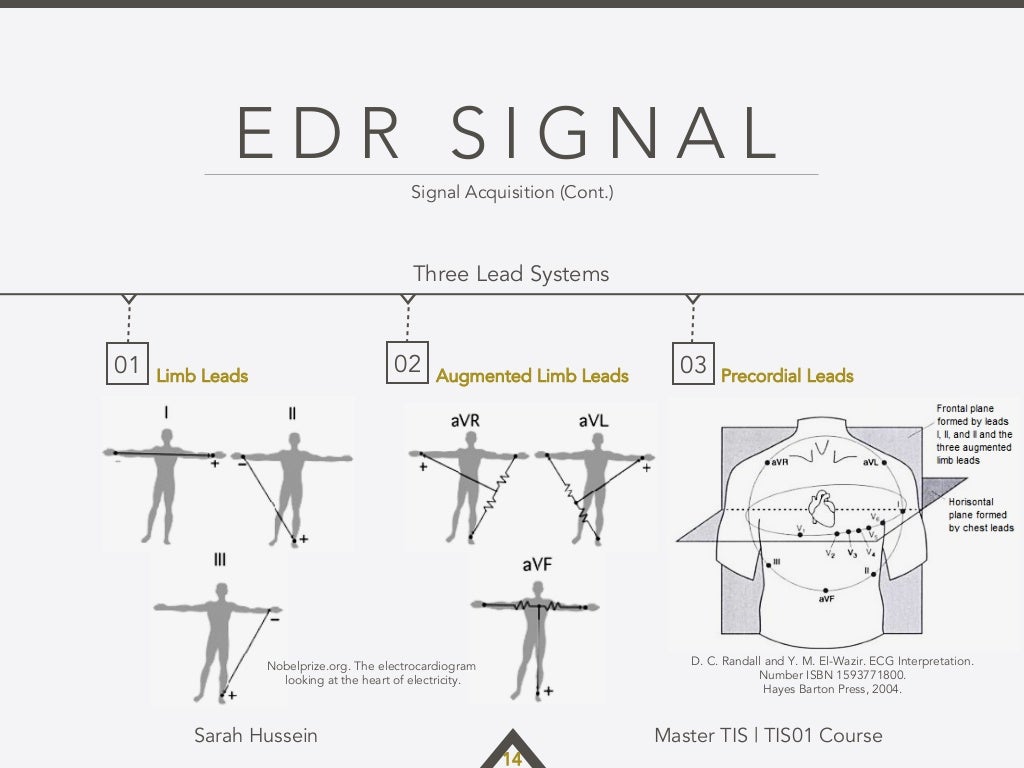 Electrocardiogramm Derived Respiratory Signal (EDR signal)