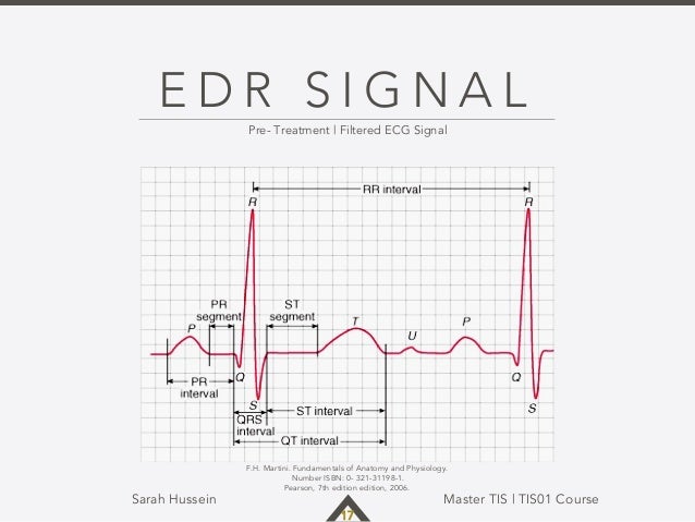 Electrocardiogramm Derived Respiratory Signal (EDR signal)