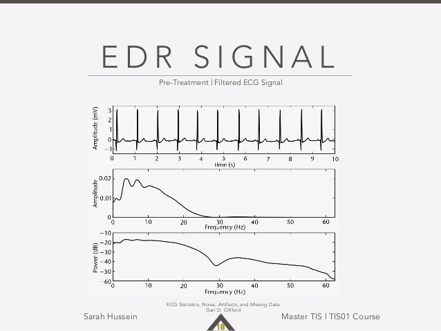 Electrocardiogramm Derived Respiratory Signal (EDR signal)