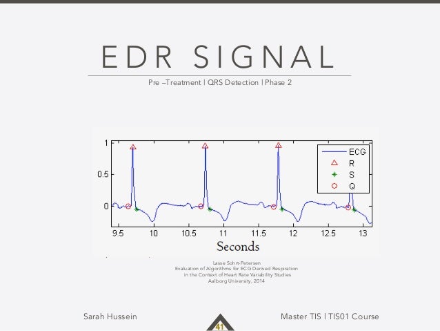 Electrocardiogramm Derived Respiratory Signal (EDR signal)
