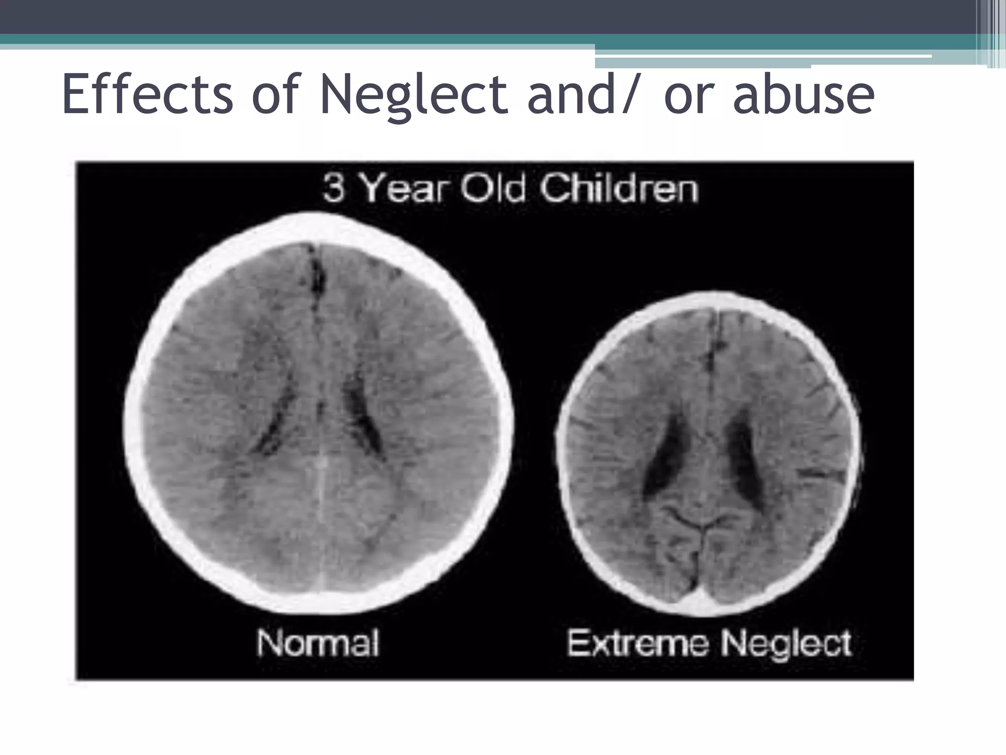 Education 1 : Brain development | PPTX