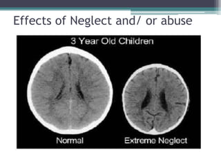 Education 1 : Brain development | PPTX