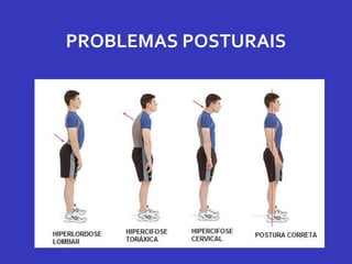 educao postural educação física escolar.. | PPTX