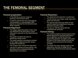 Total Knee Replacement | PPTX