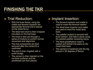 Total Knee Replacement | PPTX