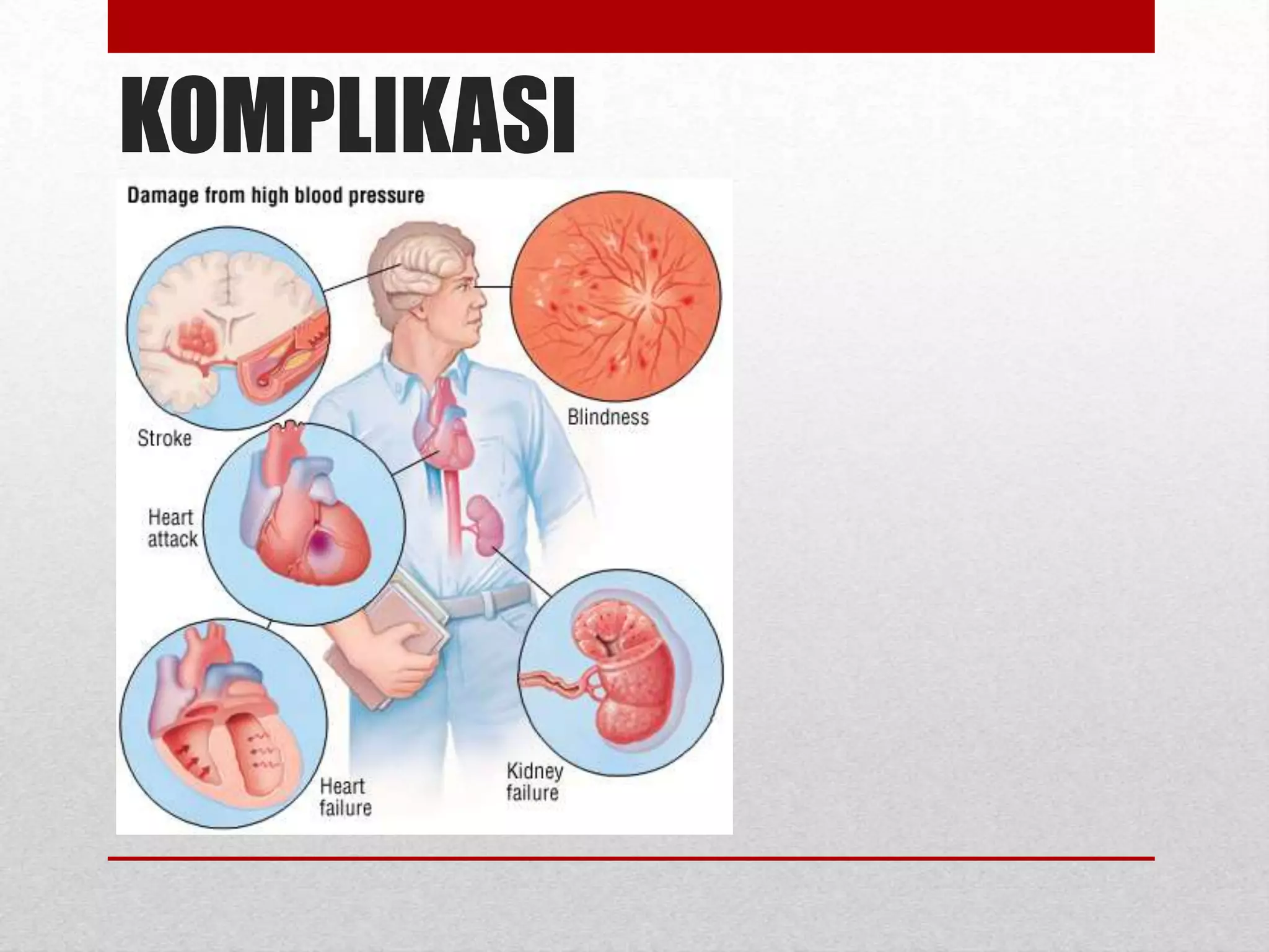 edukasi penyakit prioritas-HIPERTENSI 9704.ppt