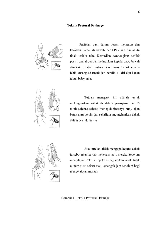 Edukasi postural drainage | PDF