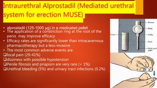 Erectile dysfunction updates | PPT