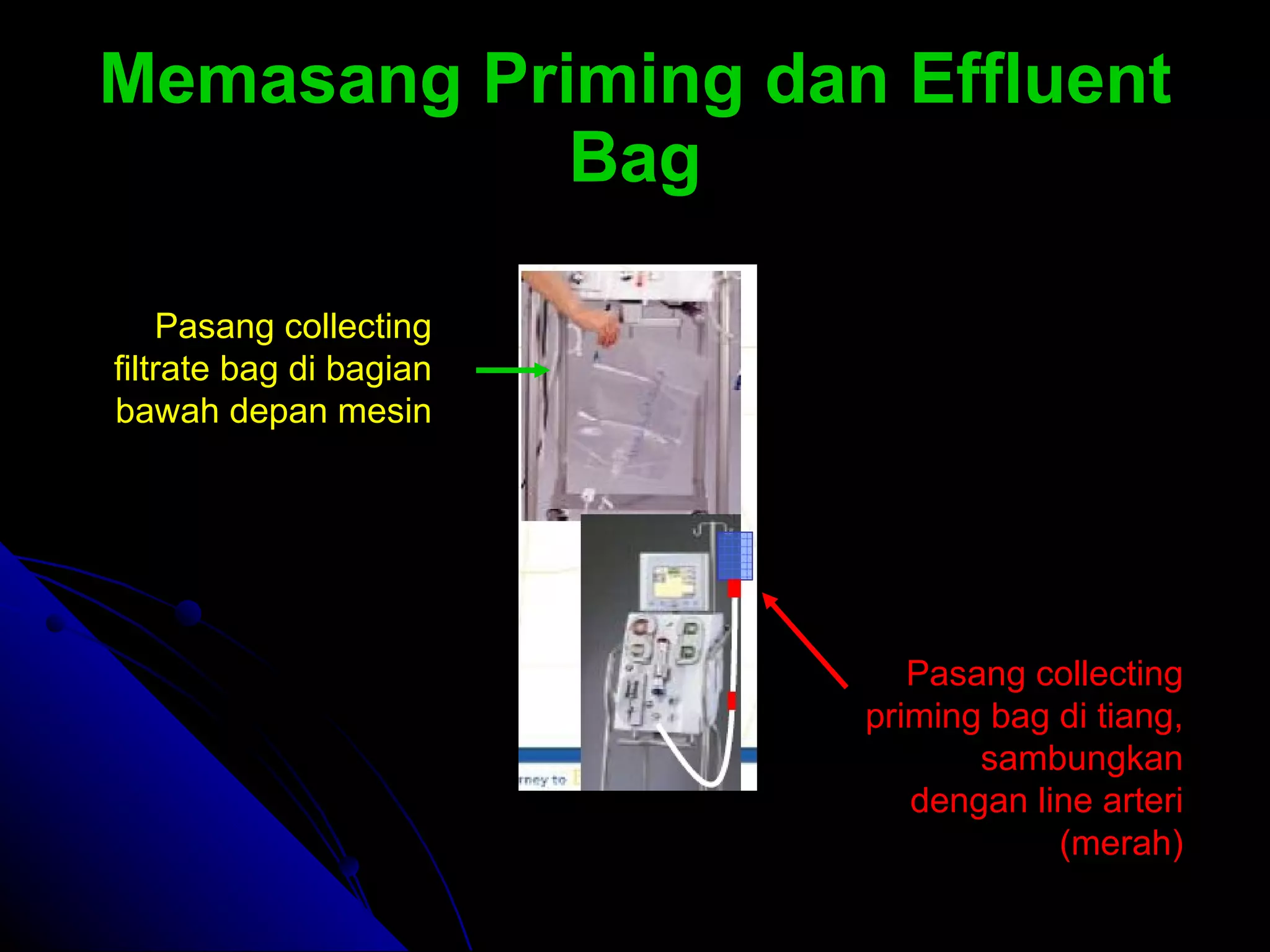 Priming dan Troubleshooting CRRT Edward Aquarius | PPS