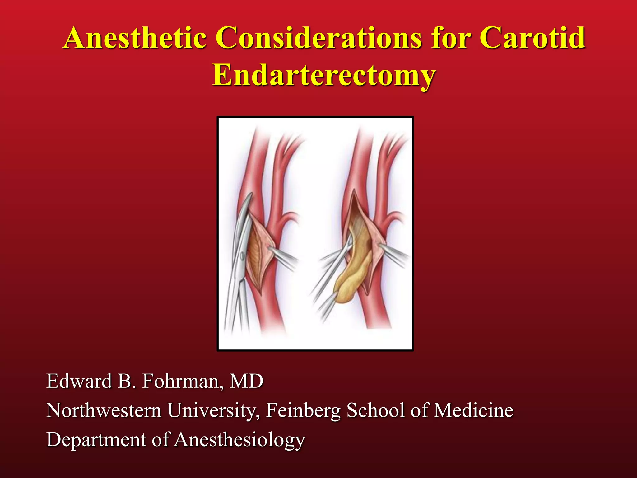 Edward Fohrman | Anesthetic Considerations for Carotid Endarterectomy | PDF