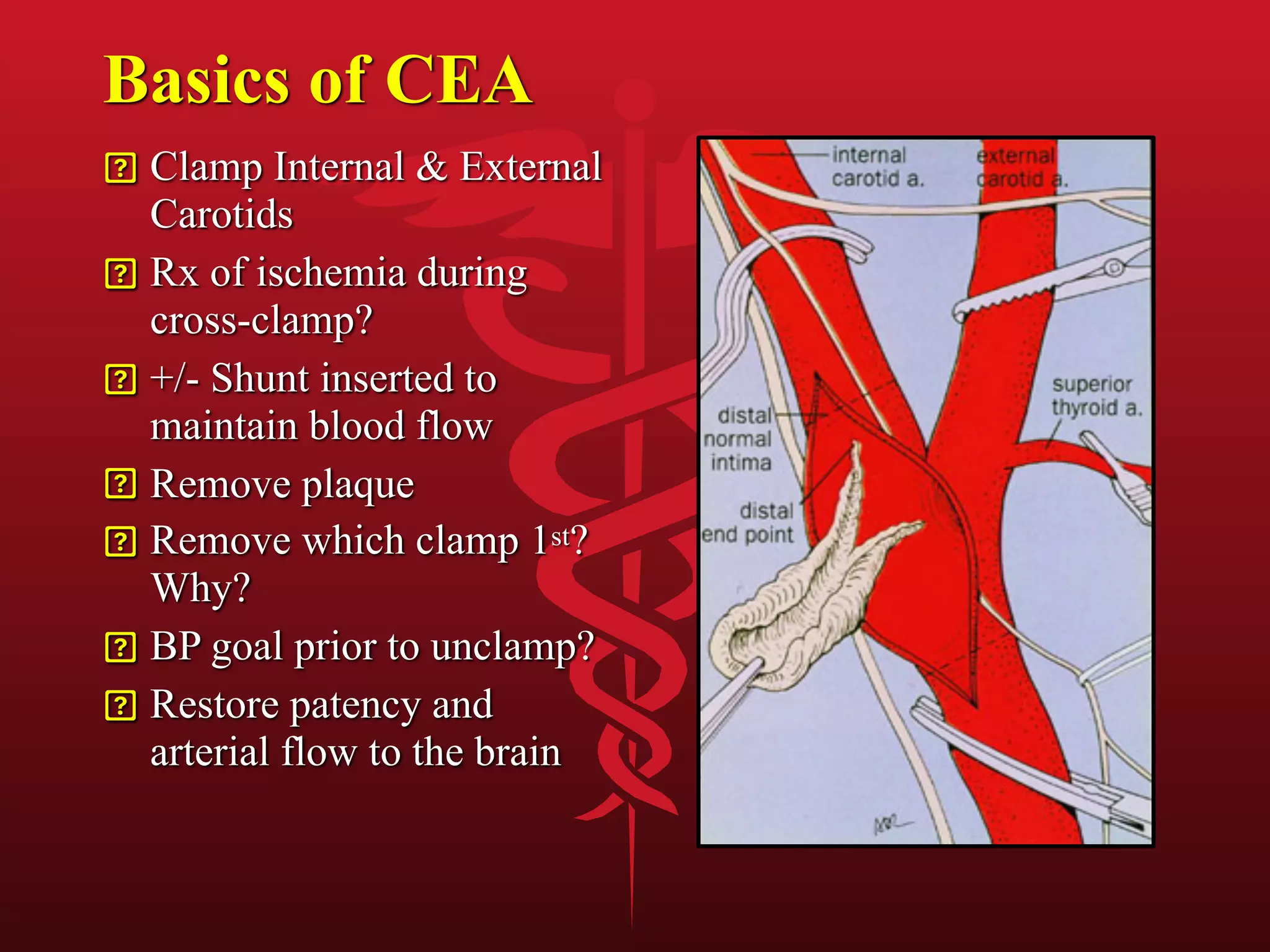 Edward Fohrman | Anesthetic Considerations for Carotid Endarterectomy | PDF
