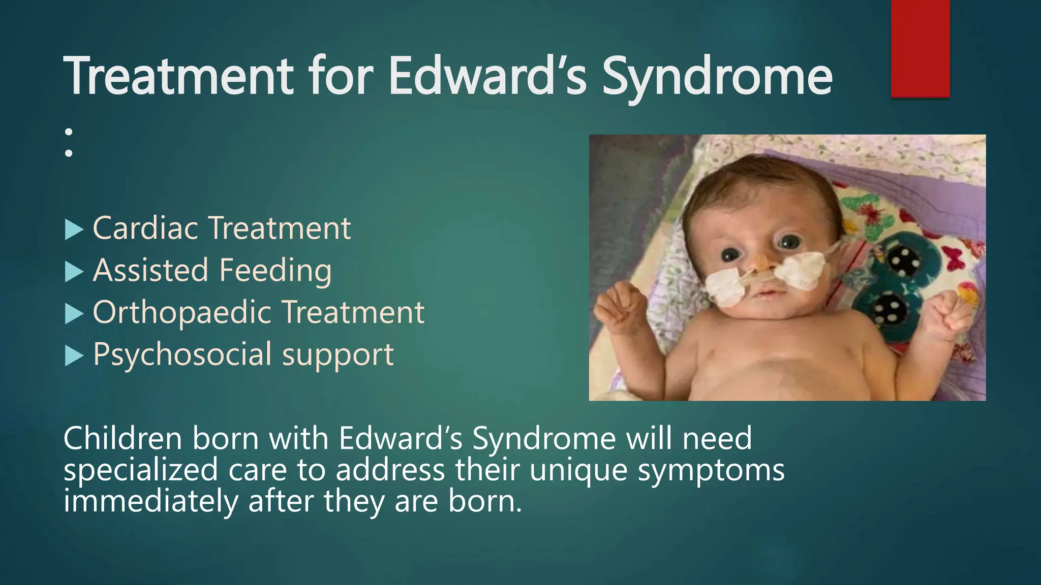 Edwards-Syndrome trisomy 18 presentation | PPTX