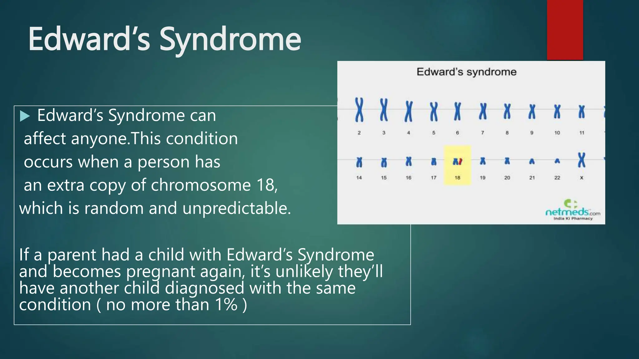 Edwards-Syndrome trisomy 18 presentation | PPTX