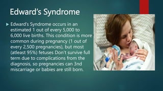 Edwards-Syndrome trisomy 18 presentation | PPTX