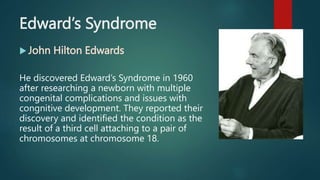 Edwards-Syndrome trisomy 18 presentation | PPTX