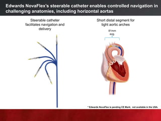 Edwards sapien xt final, nova flex and ascendra 2 | PPTX