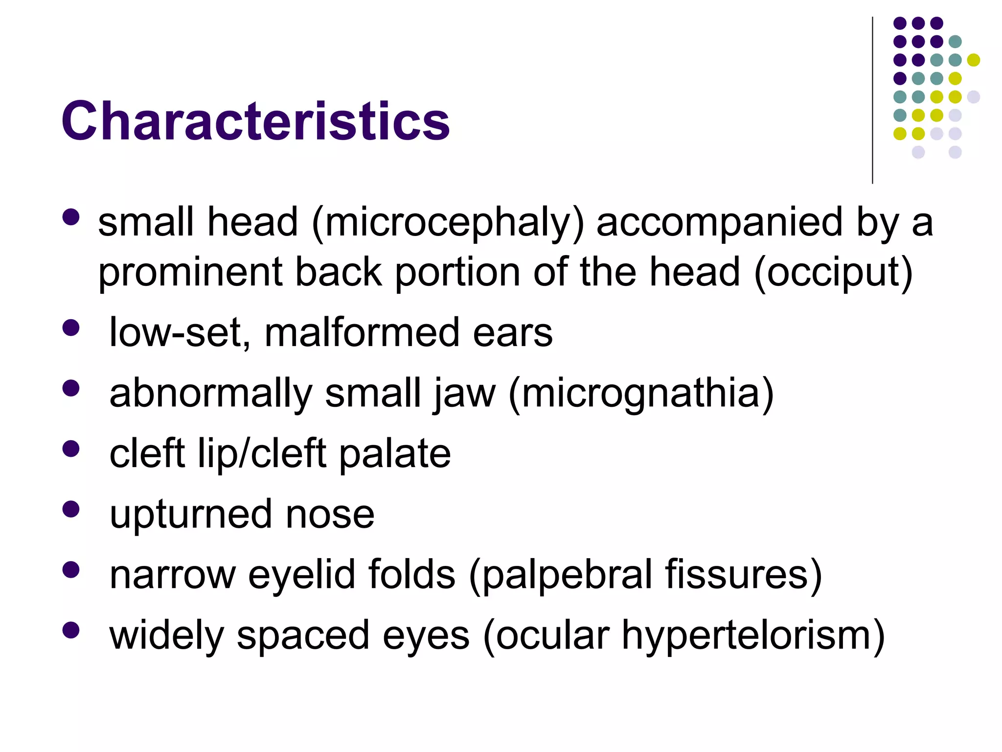 Edward's Syndrome | PPT