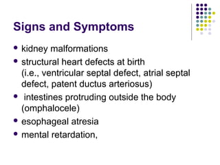 Edward's Syndrome | PPT