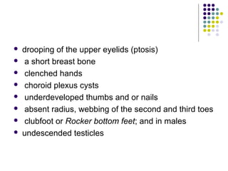 Edward's Syndrome | PPT