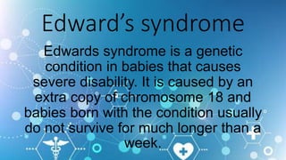 informations about Edward's syndrome from us | PPTX