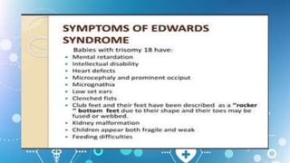 informations about Edward's syndrome from us | PPTX
