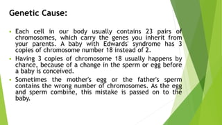 The Presentation on Edwards syndrome.pptx
